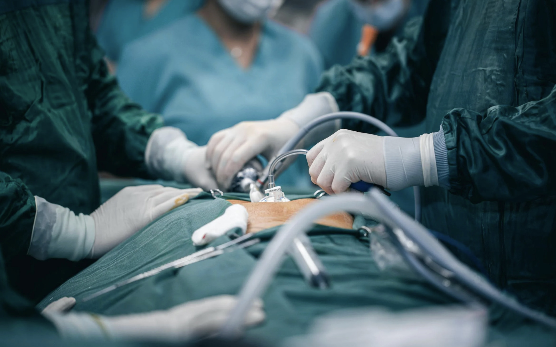 Minimally Invasive Colorectal Surgery: Laparoscopic Techniques