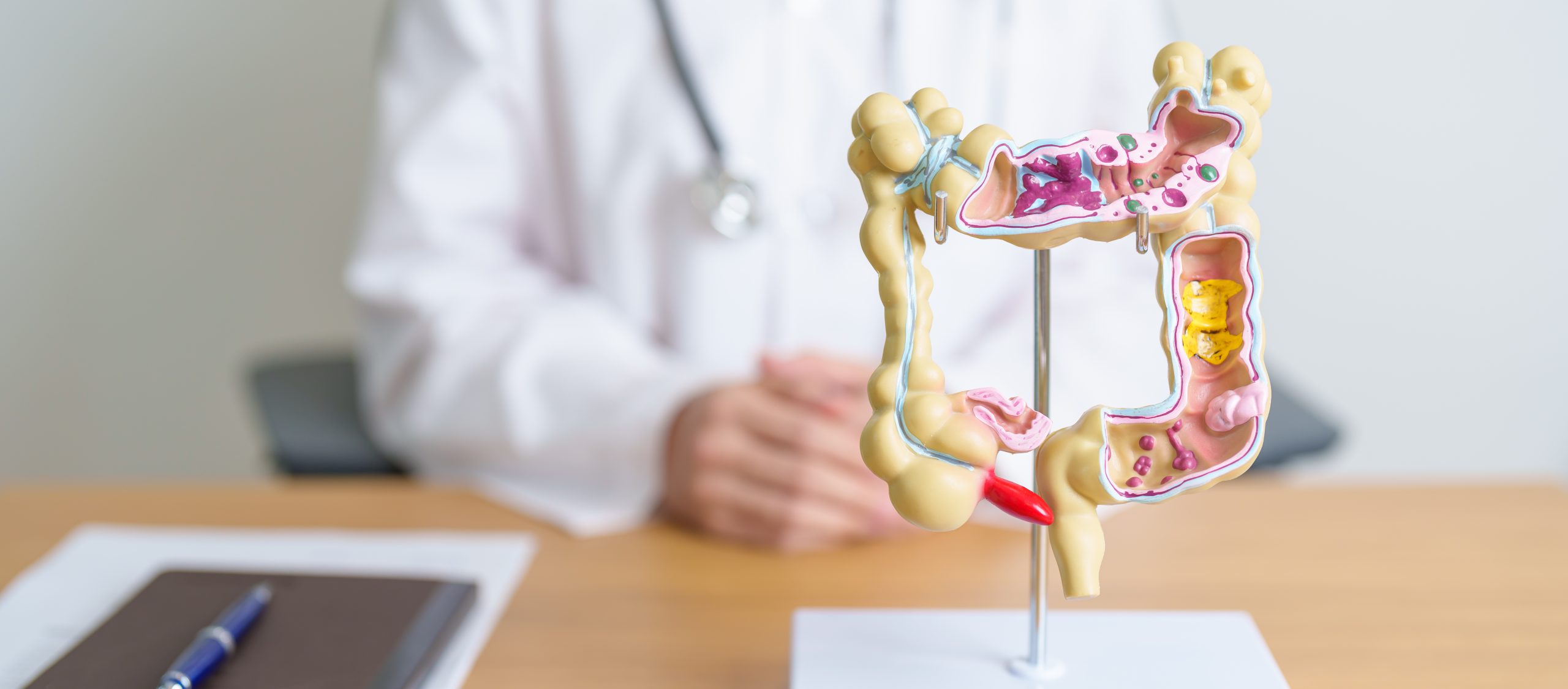 How to Prepare for a Colonoscopy: A Step-by-Step Guide - Ark Surgical ...